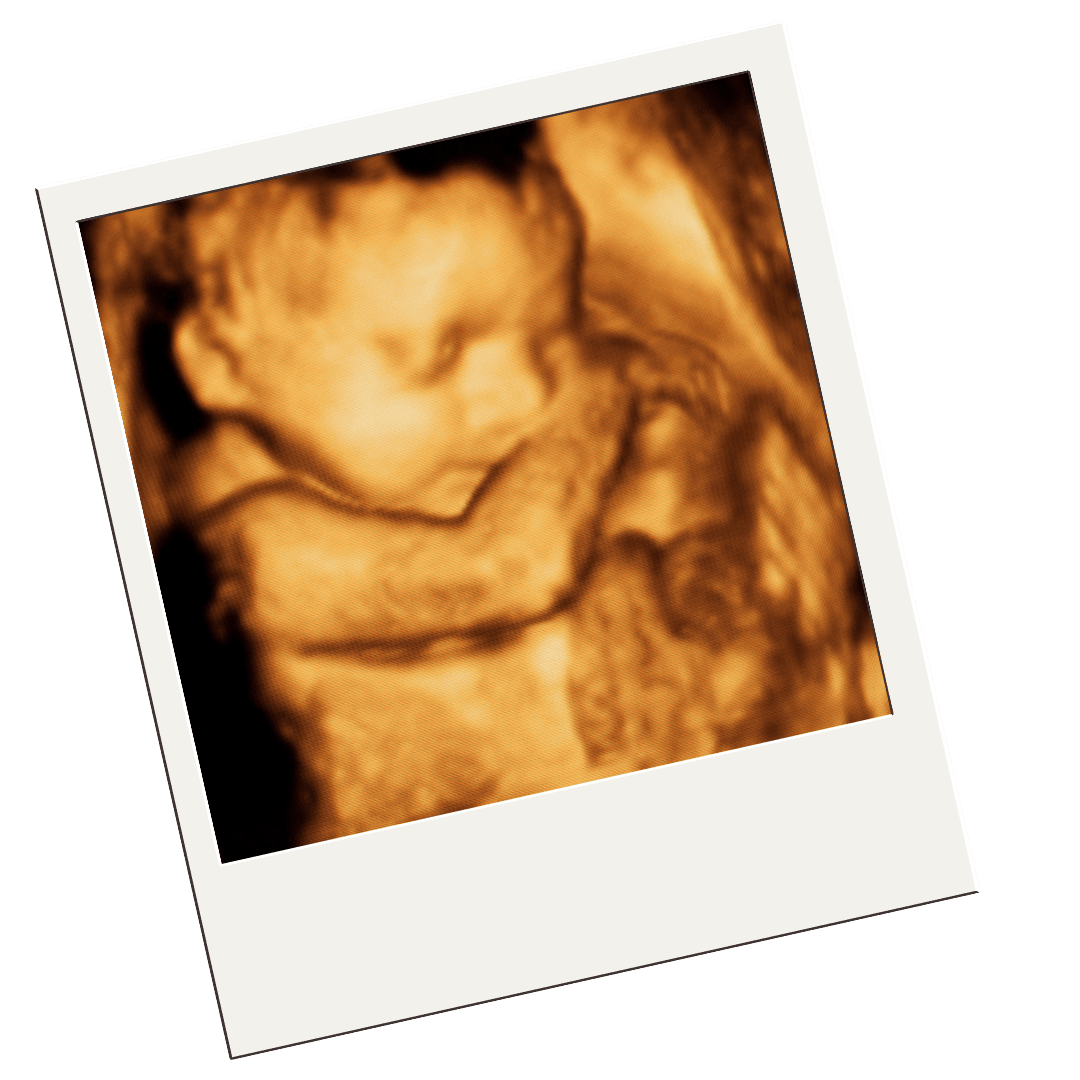 Affordable 3D/4D Pregnancy Scans with Free Gifts